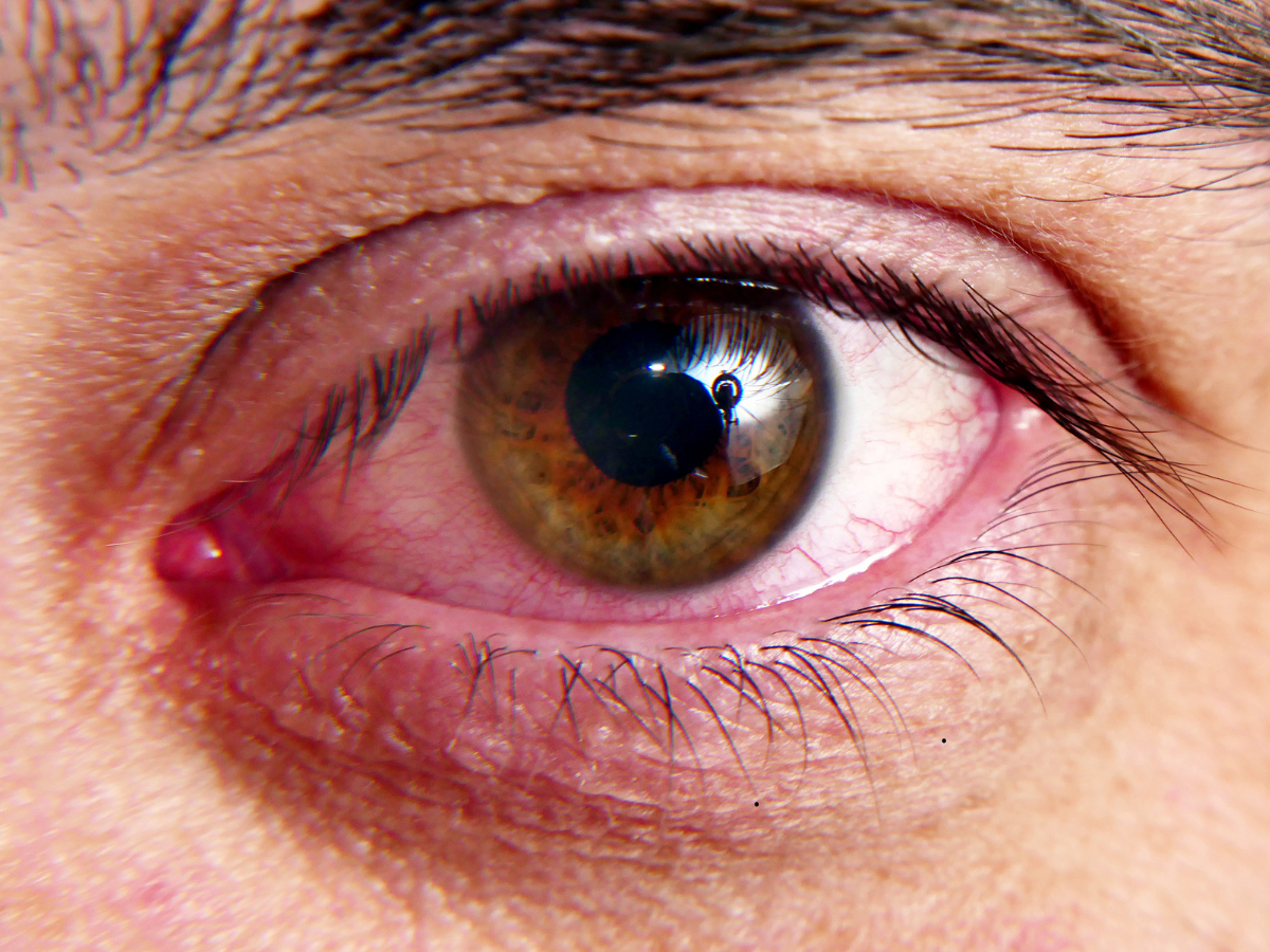 Léto je náročné i pro naše oči. Jak je správně chránit?